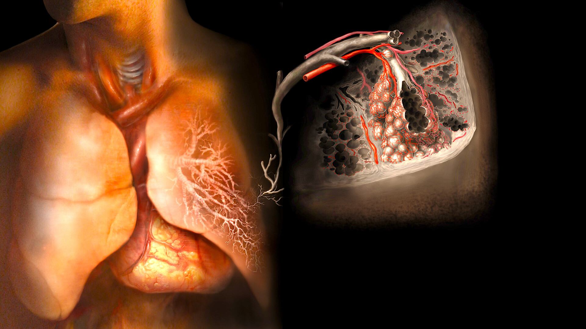 AAT Deficiency: Basic Facts About This Condition